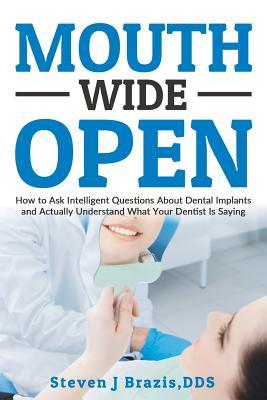Mouth Wide Open: How To Ask Intelligent Questions About Dental Implants ...