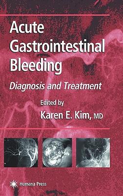 Acute Gastrointestinal Bleeding: Diagnosis and Treatment, Hardcover ...